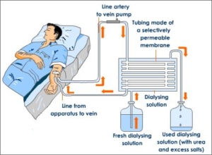 High-Quality Water Treatment Solutions for Dialysis Equipment